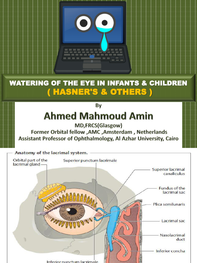 Congenital NLD Block & Hasner's Valve | PDF | Medical Specialties ...