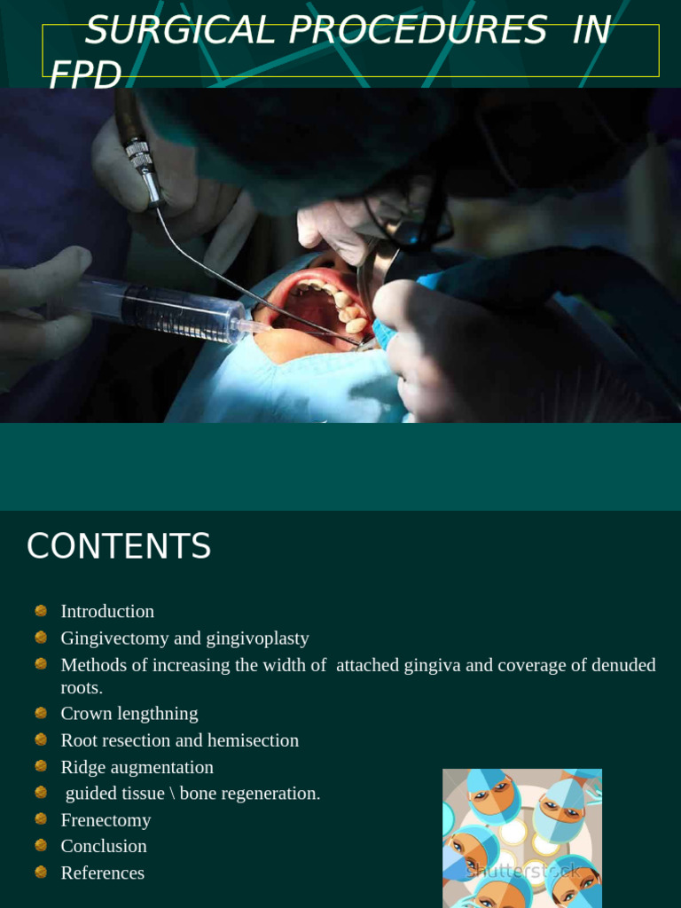 Surgical Procedures in FPD | PDF | Periodontology | Dentistry Branches