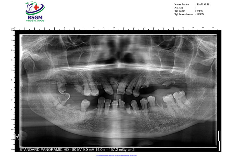 Patient Diagnostic Report for Ramalis | PDF