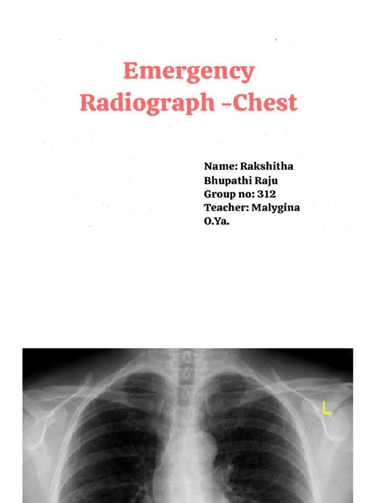 Rakshitha Bhupathi Raju 312 | PDF