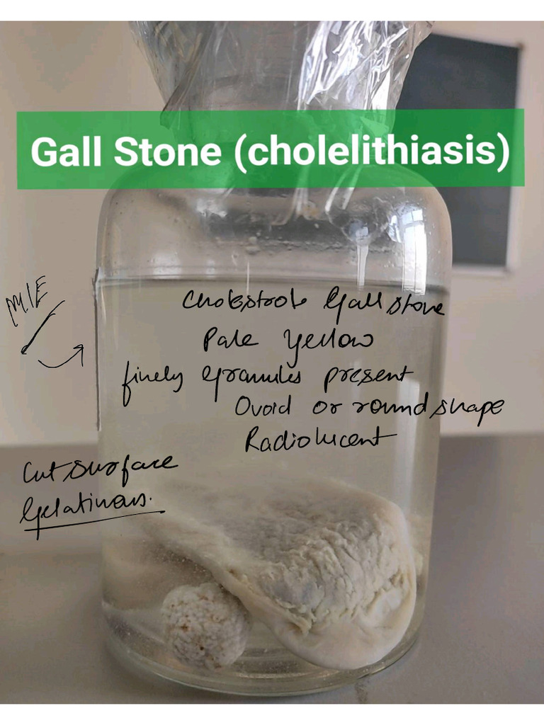 Patho Specimen - 1 | PDF