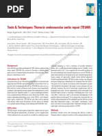 GORE® EXCLUDER® Endoprosthesis IFU | PDF | Aorta | Ischemia