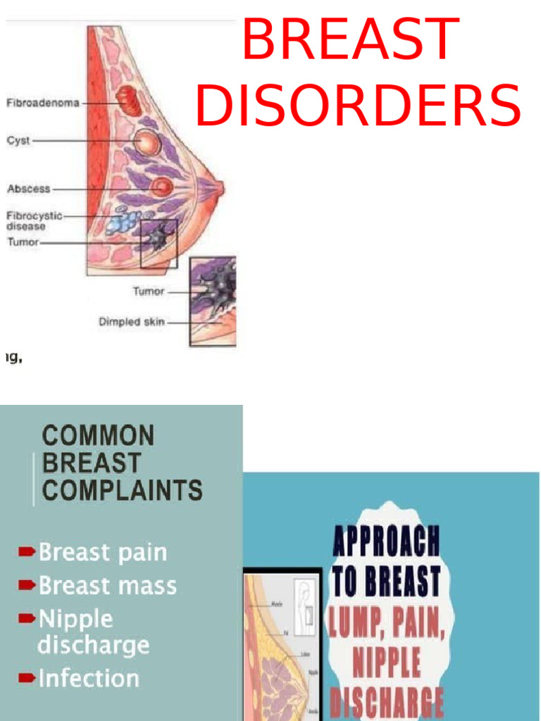 Breast Disorders | PDF | Diseases And Disorders | Medical Specialties