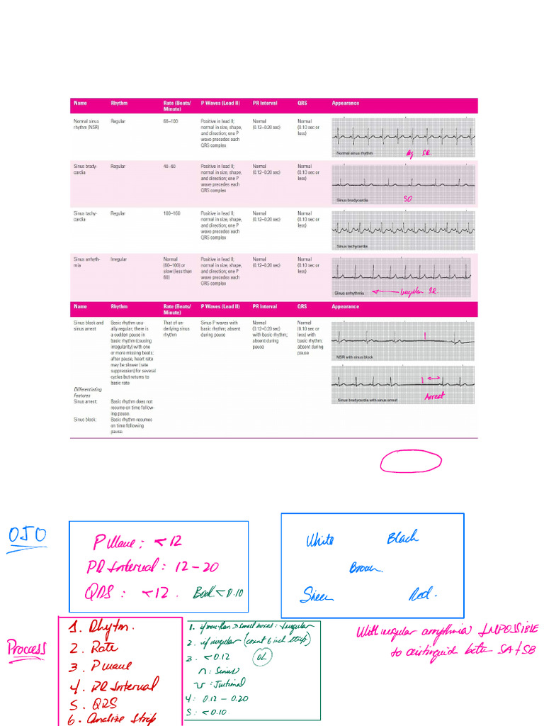 Complex ECG Interpretation Guide | PDF