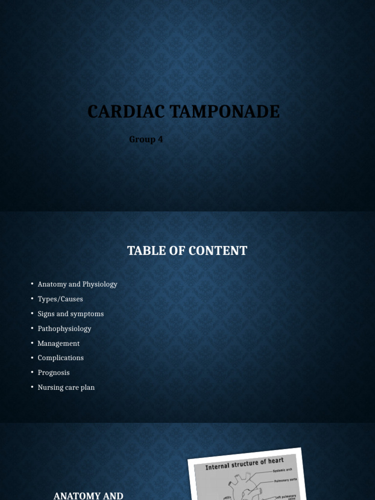 Understanding Cardiac Tamponade | PDF