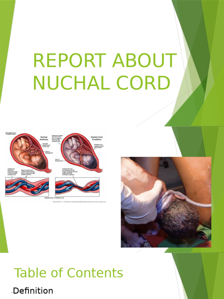 MCN-NUCHAL-CORD | PDF | Childbirth | Fetus