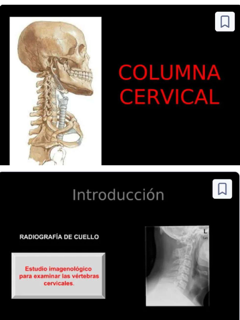 RX Columna | PDF