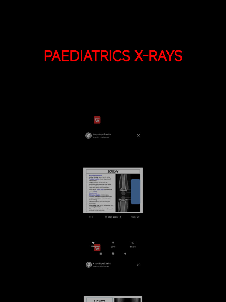 PEDIATRICS X-RAYS | PDF