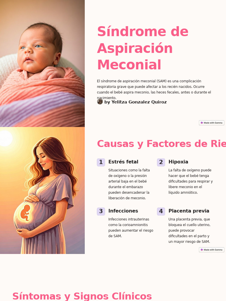 Síndrome de Aspiración Meconial: Causas y Tratamiento | PDF | Parto ...