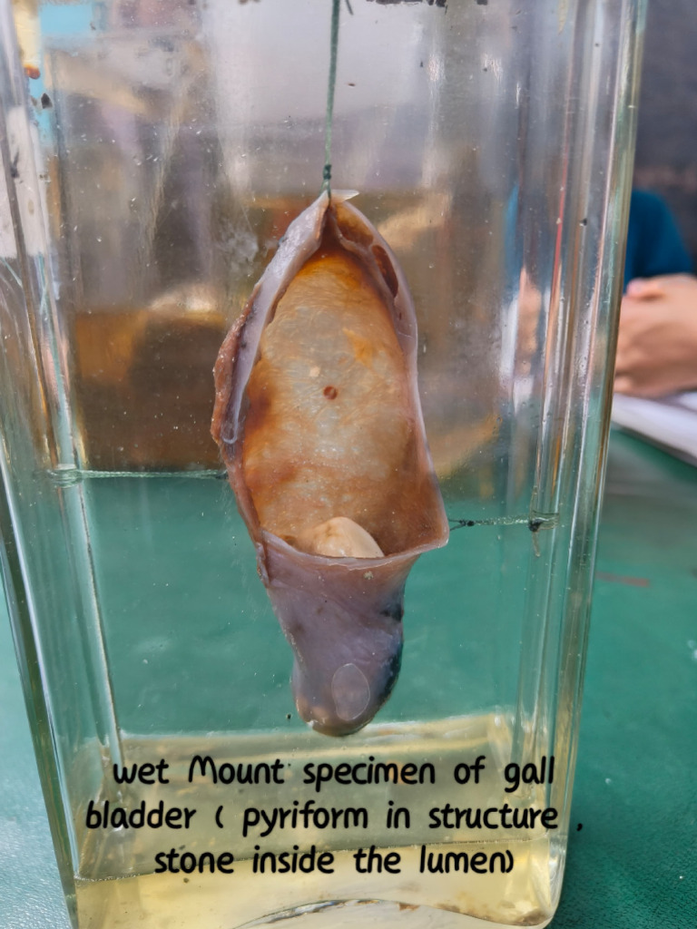 Surgery Specimen | PDF