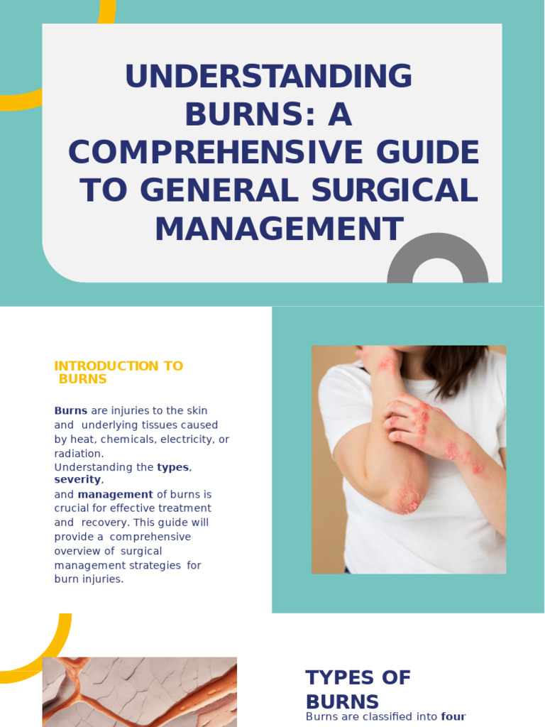 Slidesgo Understanding Burns A Comprehensive Guide To General Surgical Management ...
