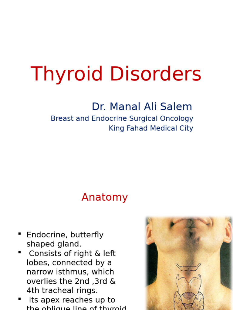 Thyroid Disorder - Final 1 | PDF | Thyroid | Hyperthyroidism