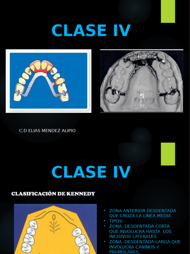 Tema #16 Clase IV en Ppr (1) | PDF