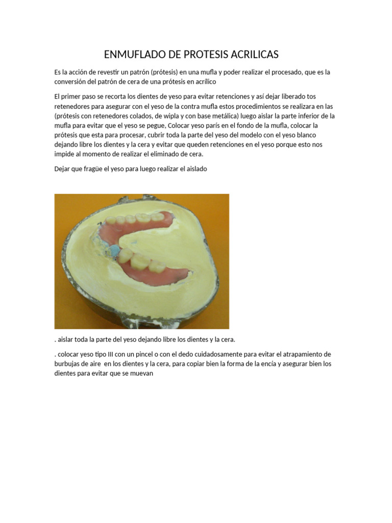 12 ENMUFLADO DE PROTESIS ACRILICAS (2) (1) (1) | PDF