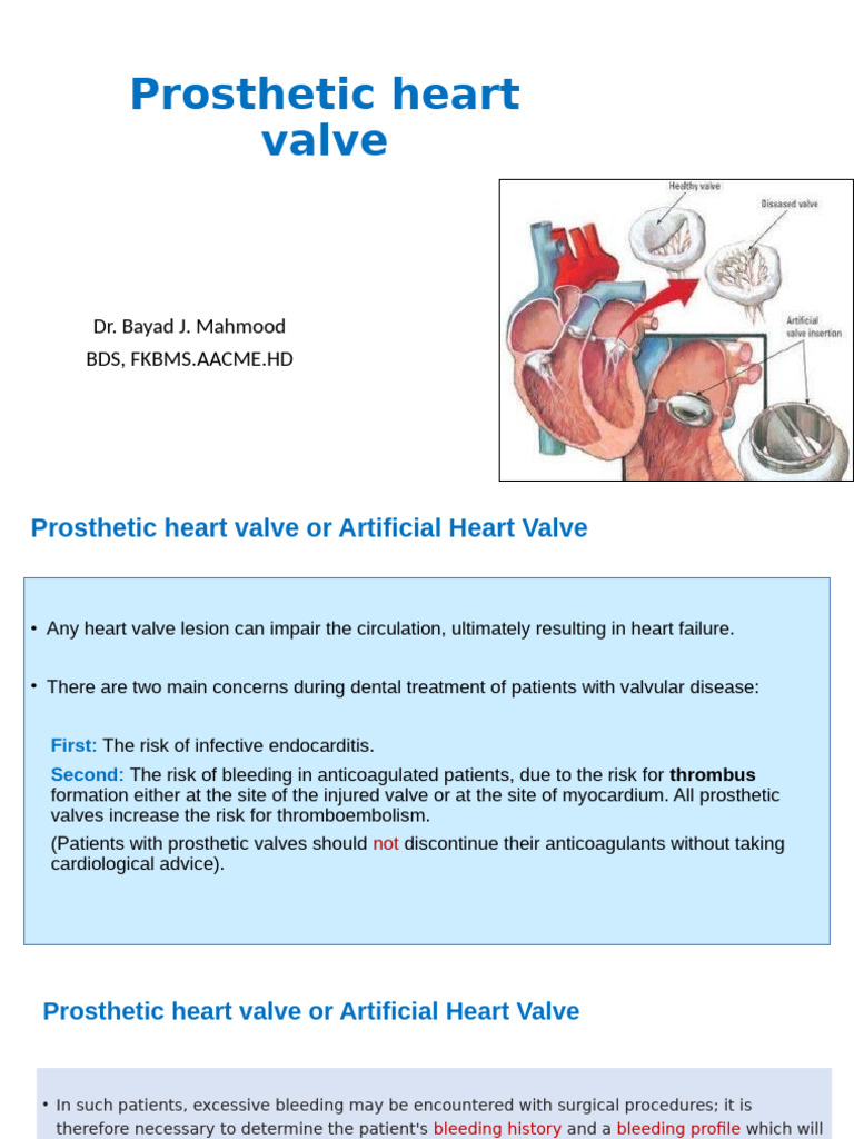 Dental Care for Prosthetic Heart Valves | PDF | Heart | Internal Medicine