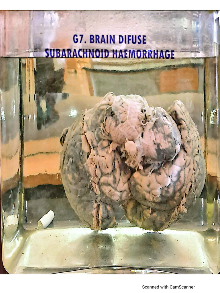 Forensic Medicine Practical Wet Specimens | PDF