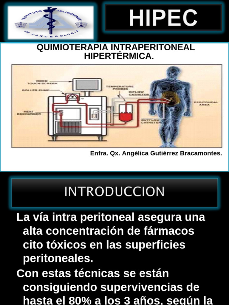 Quimioterapia Intraperitoneal Hipertérmica | PDF | Abdomen | Peritoneo