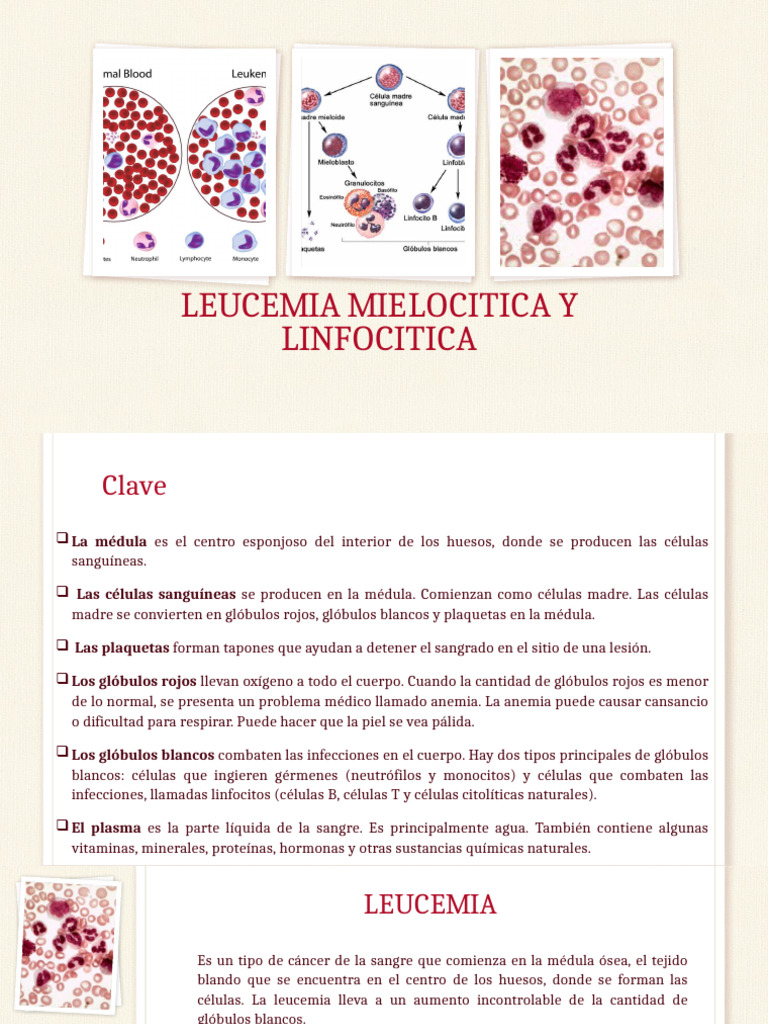 Tipos y Tratamientos de Leucemia | PDF | Leucemia | Sangre