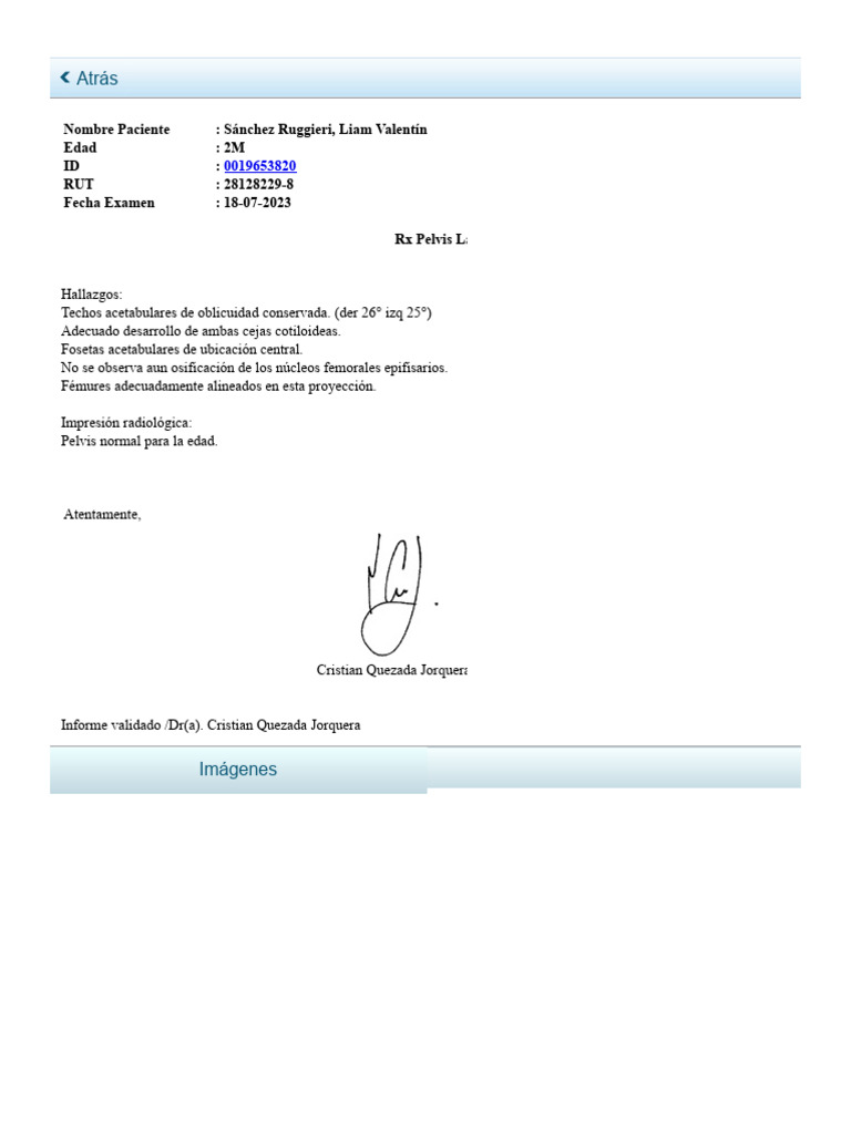 Informe RX Cadera 3 Meses Liam | PDF