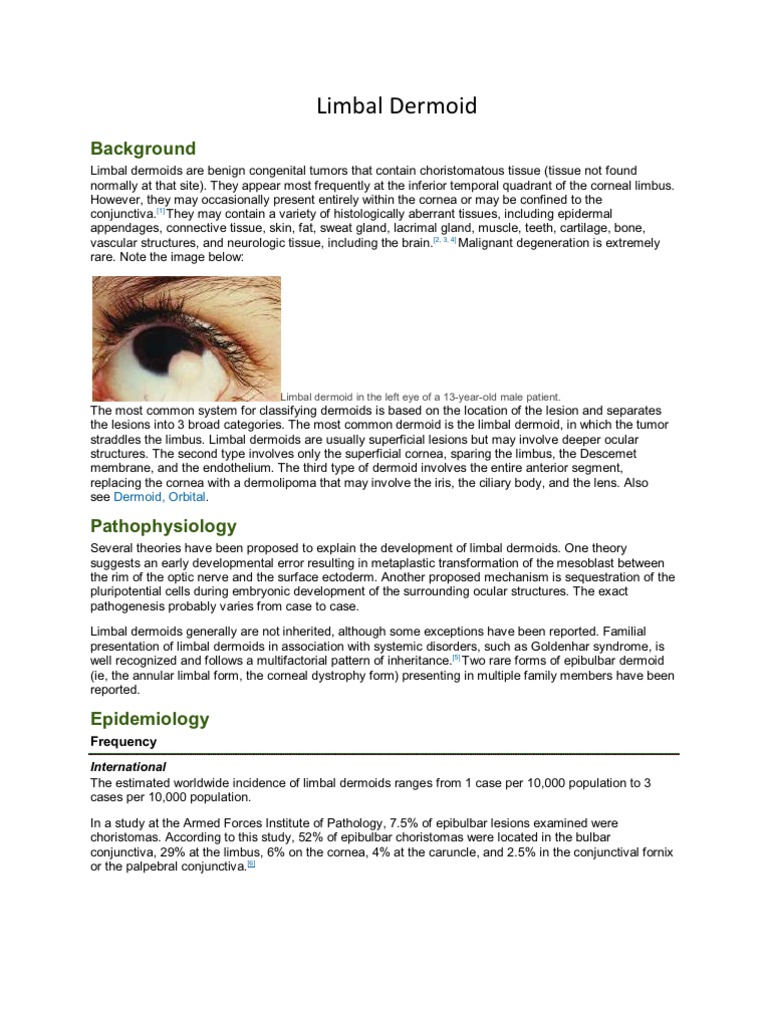 Limbal Dermoid | Cornea | Human Eye