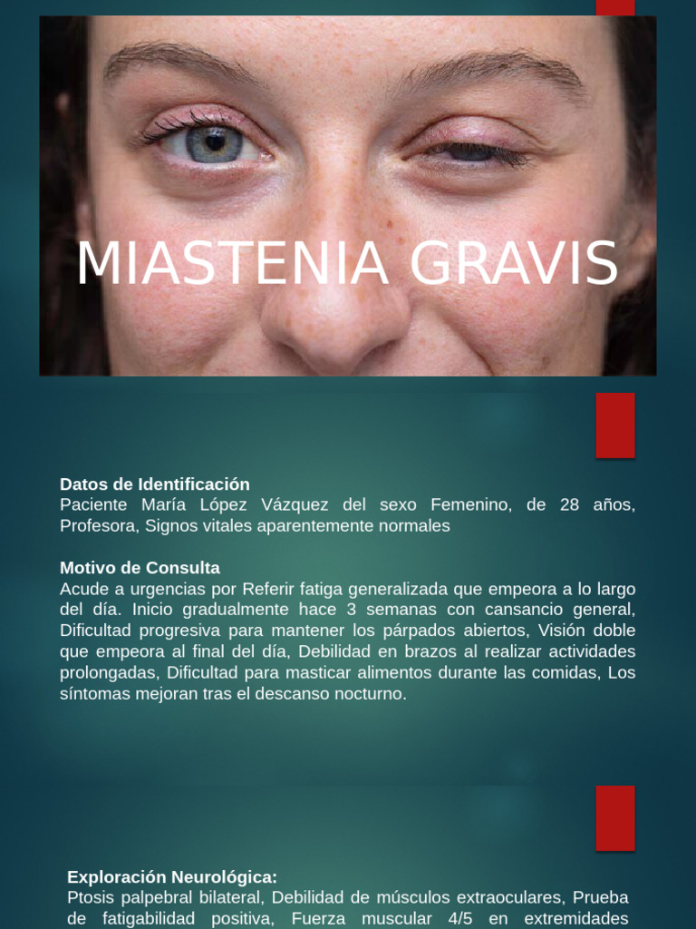 Diagnóstico y Tratamiento de Miastenia Gravis | PDF