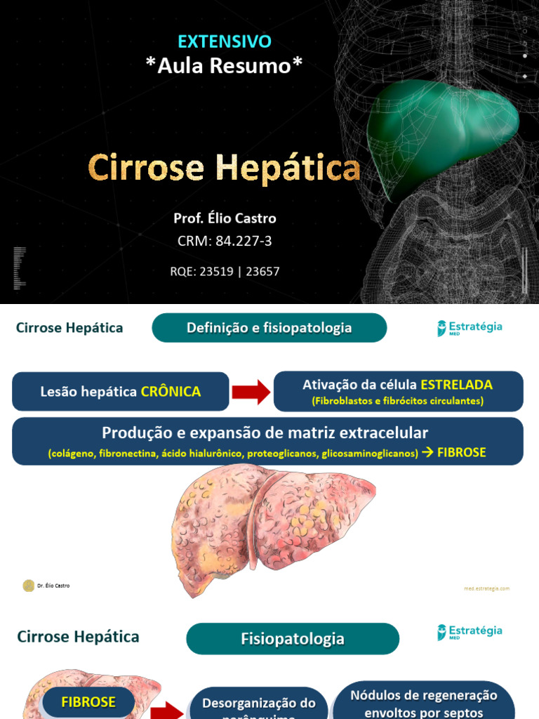 Cirrose Hepática - Aula Re PDF | PDF | Cirrose | Fígado