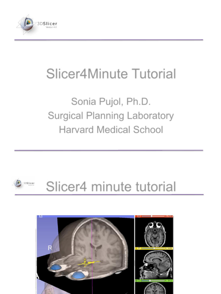 Slicer4minute Tutorial - SoniaPujol MJ | PDF | Computer Graphics | Software