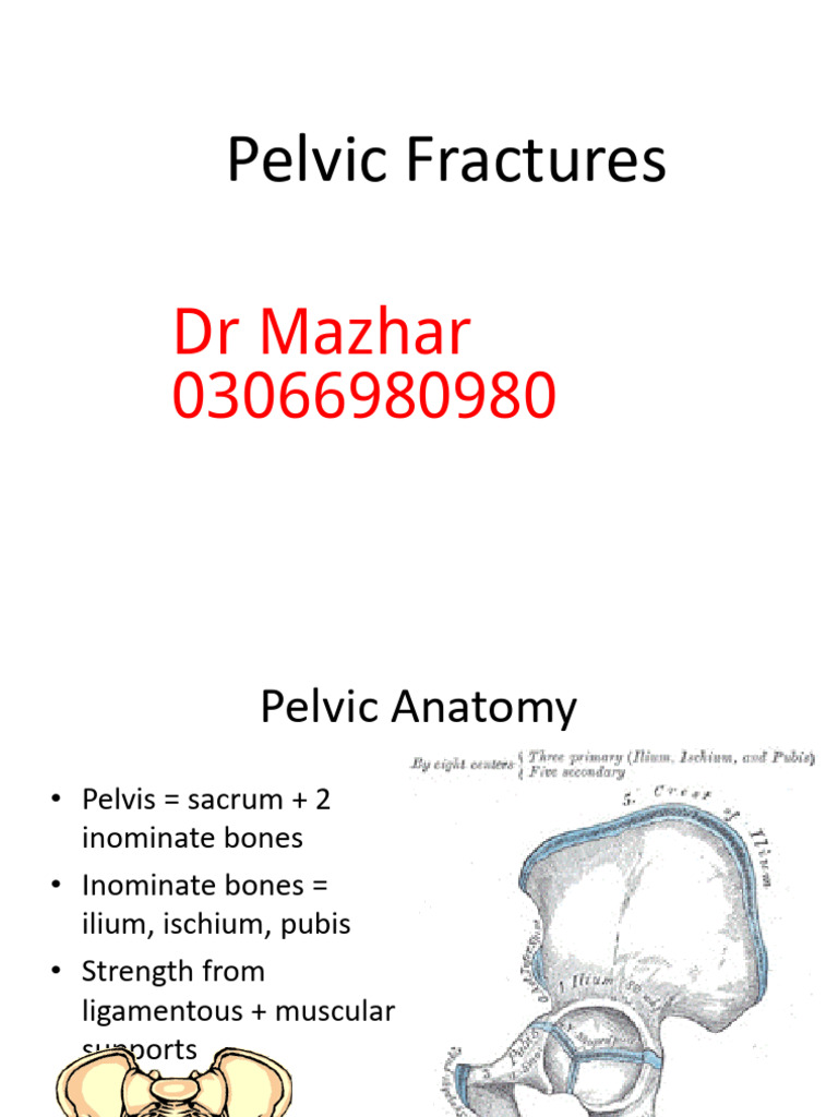 Pelvic Hip Fractures.......... DR Mazhar | PDF | Pelvis | Musculoskeletal System