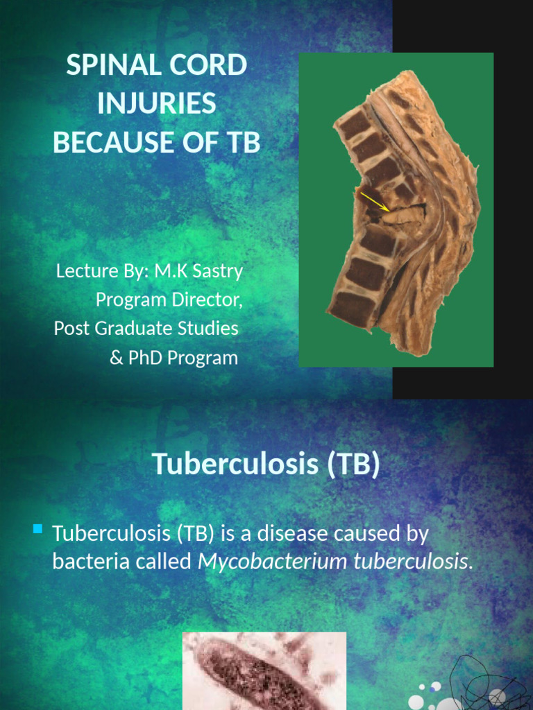 Spinal Cord Injuries Because of TB | PDF | Tuberculosis | Vertebral Column
