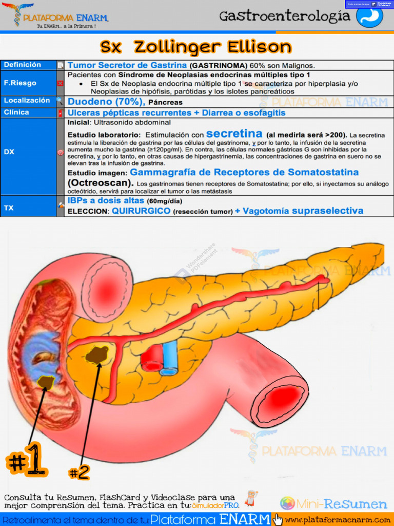 1-Sx Zollinger Ellison (Mini-Resumen) | PDF