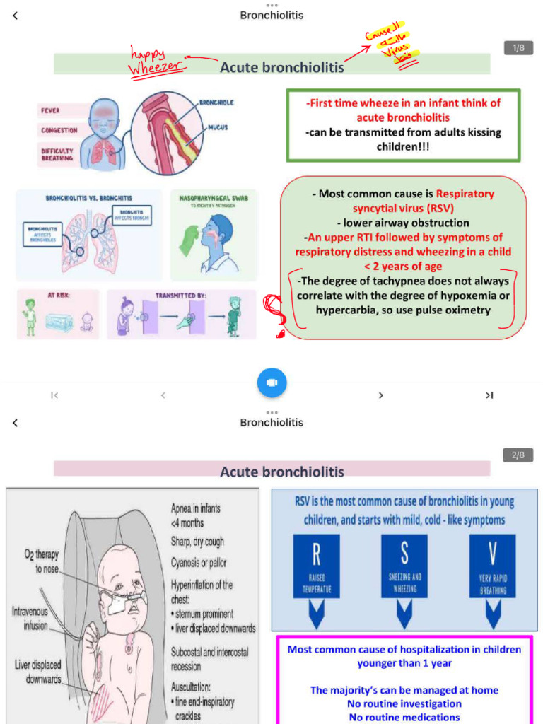 Bronchiolitis Summary | PDF