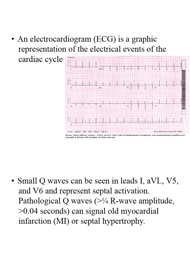 EKG For Lab-1 | PDF | Electrocardiography | Myocardial Infarction