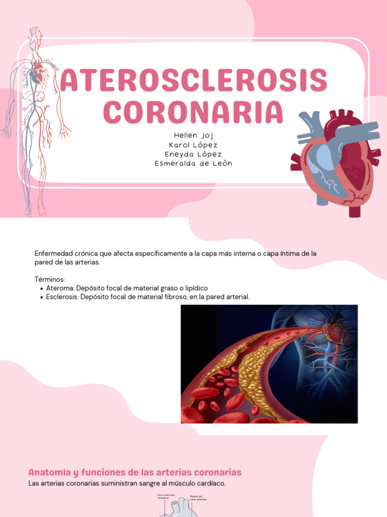 Aterosclerosis Coronaria: Causas y Tratamiento | PDF | Aterosclerosis ...