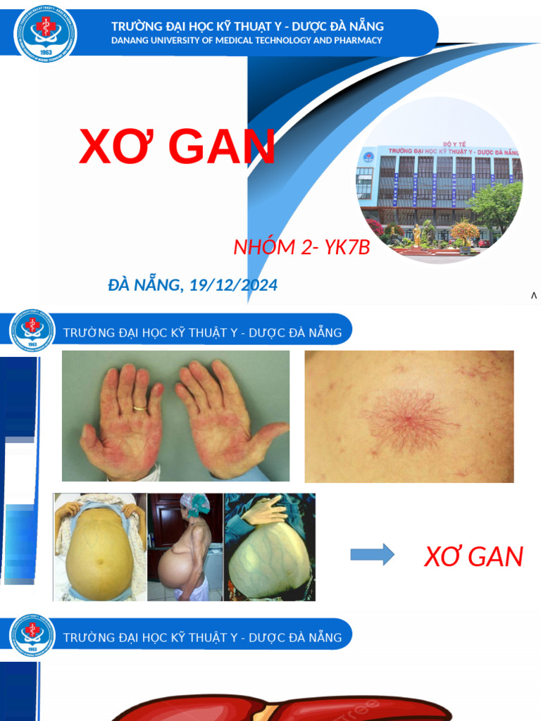 Xo Gan | PDF