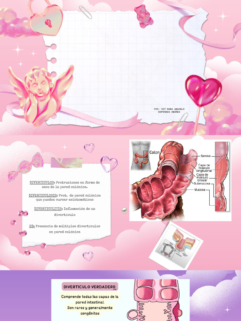 Diverticulitis Enf Diverticular | PDF