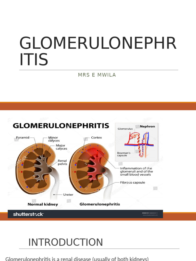 Glomerulonephritis PPT Presentation MRS Mwila | PDF | Kidney | Kidney Disease