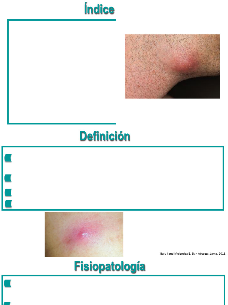 Absceso cutáneo | PDF | Especialidades Medicas | Enfermedades y trastornos
