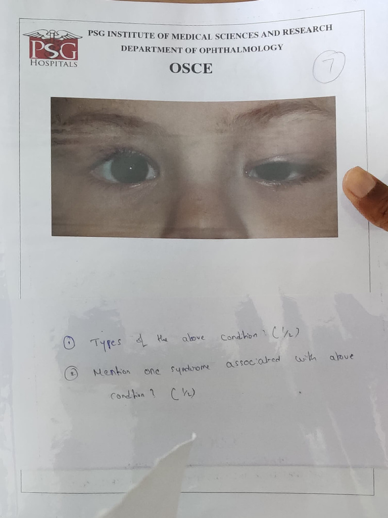 Ophthal Spotters | PDF