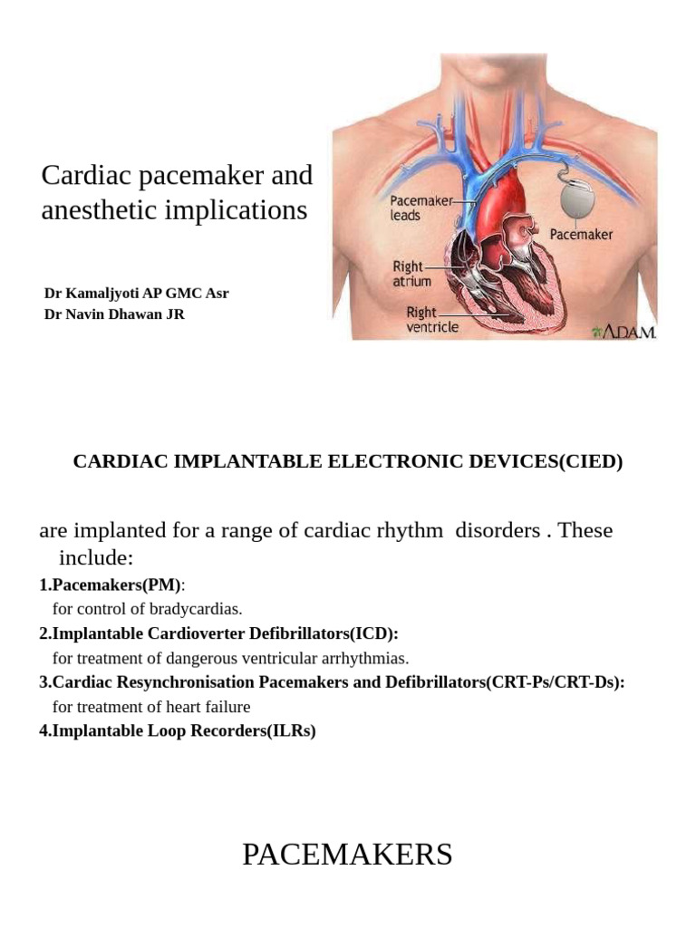 Cardiac Pacemaker and Its Anesthetic Implications-1 | PDF | Artificial ...