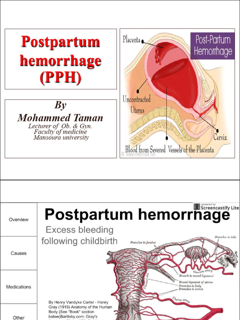 38 Postpartum Haemorrhage Manchester Copy | PDF | Medical Specialties | Human Reproduction