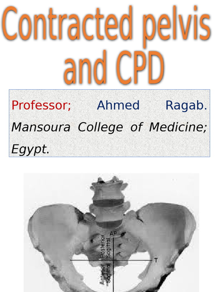 CP and CPD | PDF | Childbirth | Pelvis