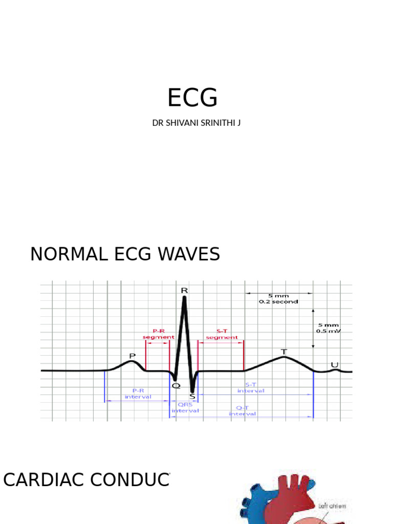 Ecg and Conduction of Heart [Autosaved] | PDF