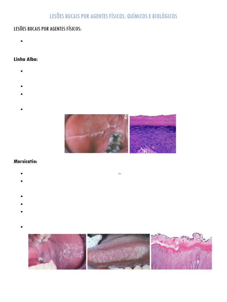 Lesões Orais: Causas e Tratamentos | PDF | HIV/AIDS | Especialidades ...