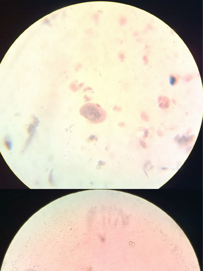 Entamoeba Histolytica | PDF