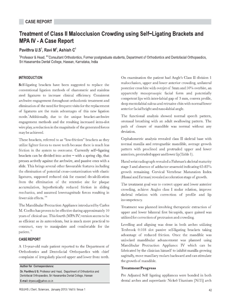 Class II Malocclusion Crowding | PDF