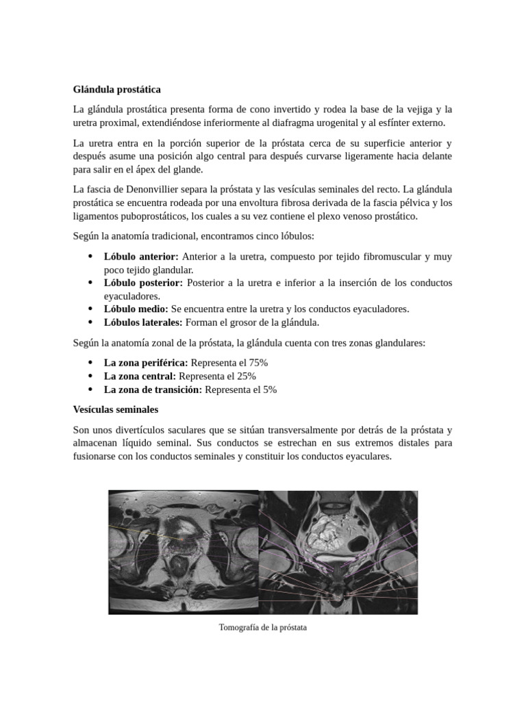 Glándula Prostática 1 | PDF