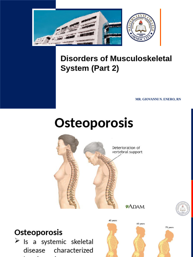 Osteoporosis-CTP | PDF