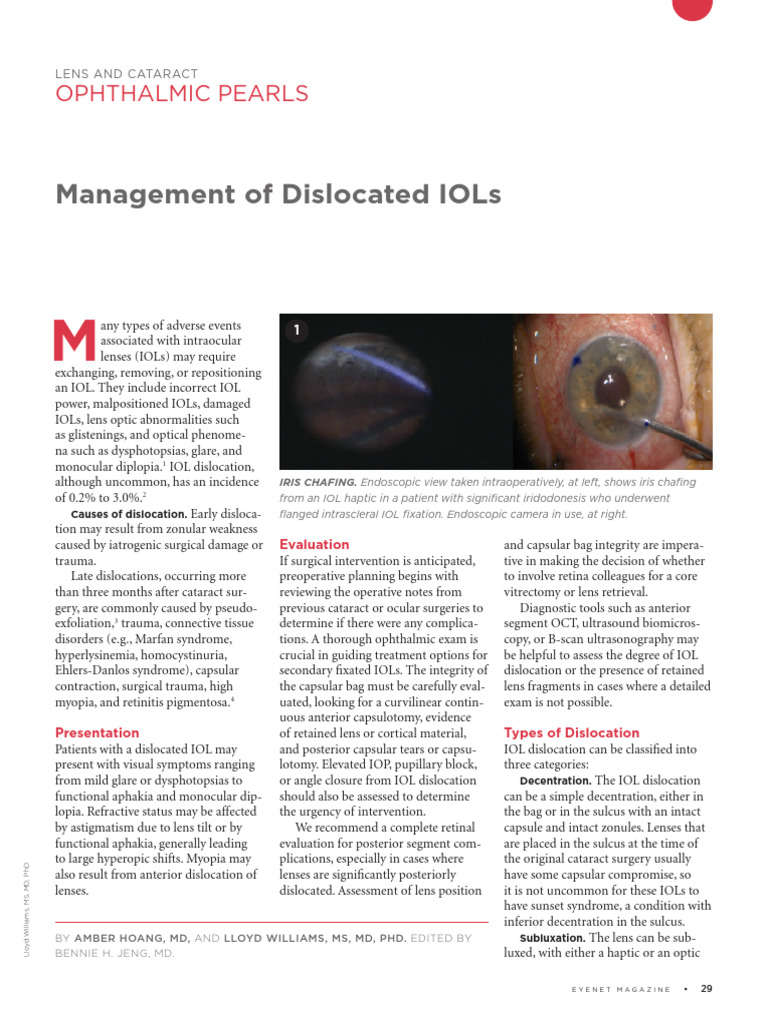 April 2022 Ophthalmic Pearls | PDF | Eye | Medical Specialties