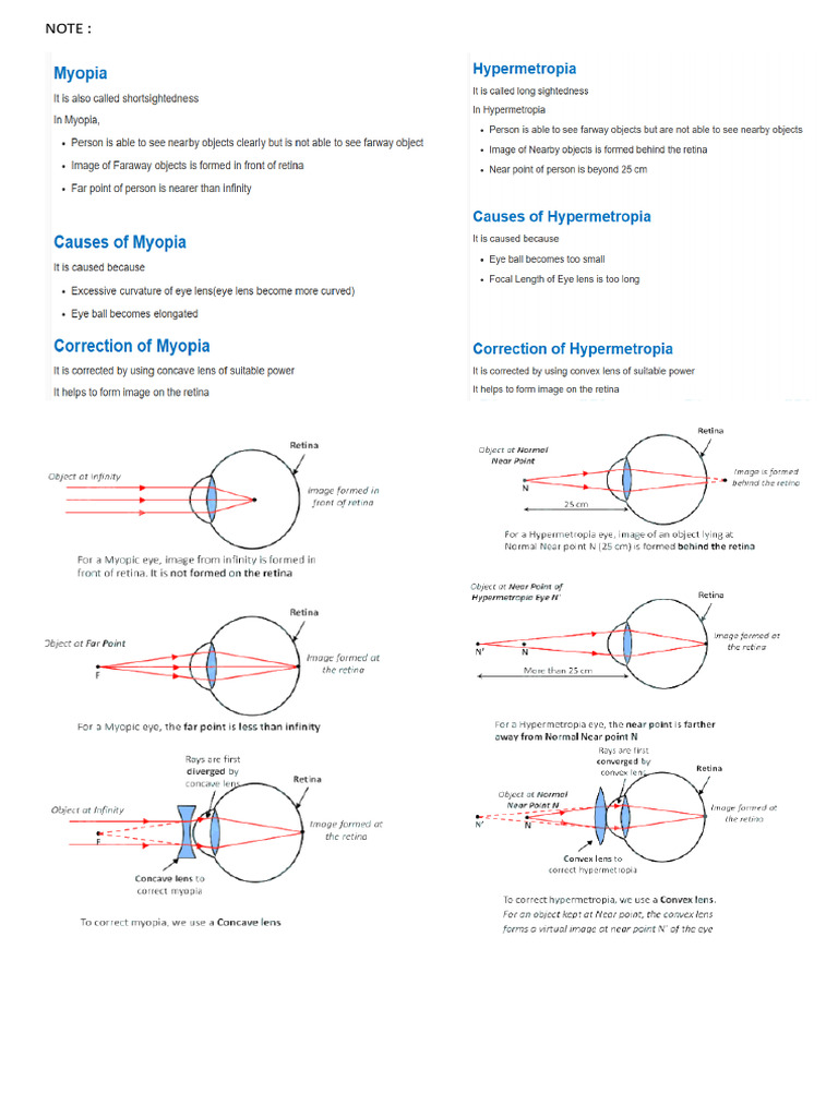 Understanding Vision Defects and Light Phenomena | PDF | Sunset | Rainbow
