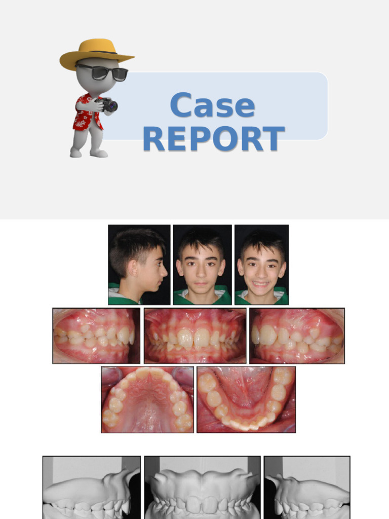 Case 1 - Orthodontic Repositioning of A Lingually Positioned ...